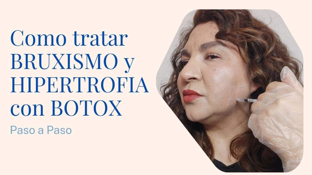 Cómo el Botox puede redefinir tu mandíbula – TITA EVE ESTÉTICA A TU ALCANCE